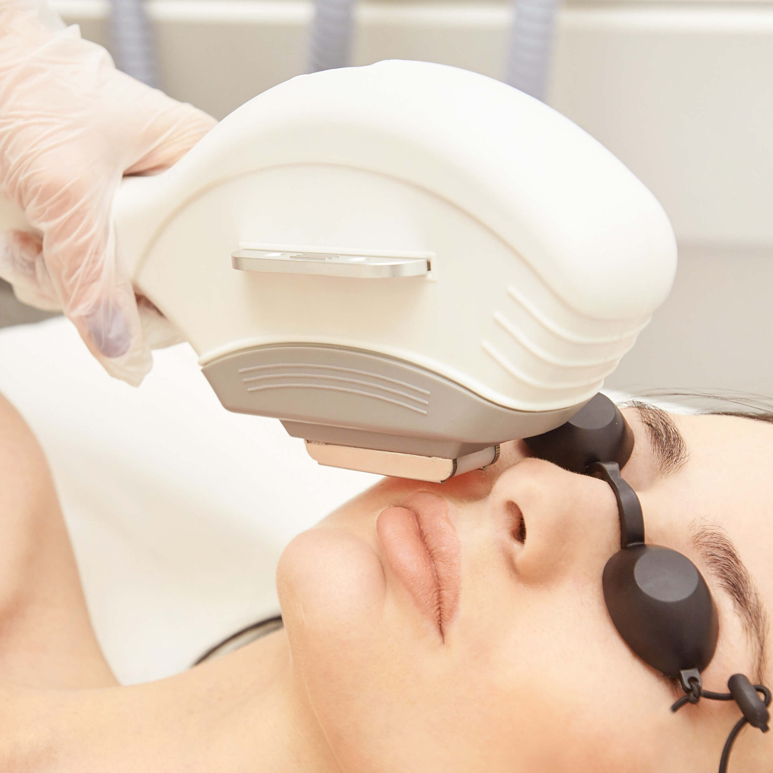 Does IPL Help with Dry Eye?